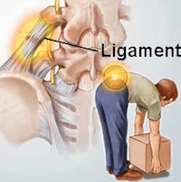 Acute Lage Rugpijn? Oefeningen & Behandeling | Fysiotherapie4all