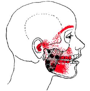 Masseter Oefeningen En Behandeling | Fysiotherapie4all