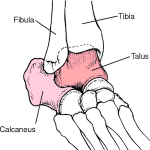 Talusfractuur Oefeningen En Behandeling | Fysiotherapie4all