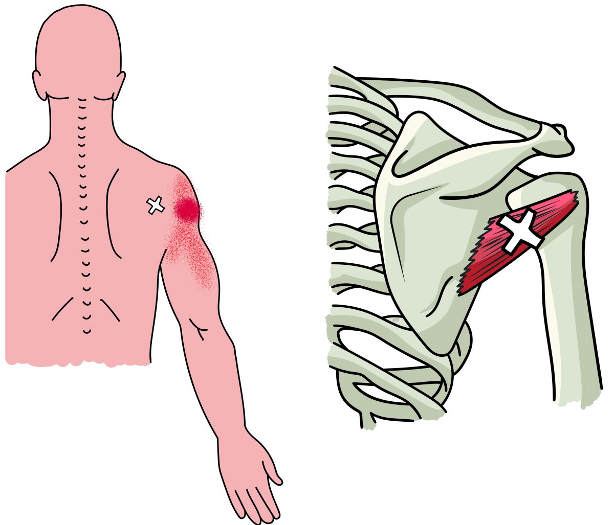 Ontdek Hoe Jouw Spieren Werken! | Fysiotherapie4all
