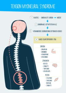 Tension Myoneural Syndrome Behandelen? Nu Gratis Ebook!