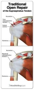 Rotator Cuff Protocol | Fysiotherapie4all