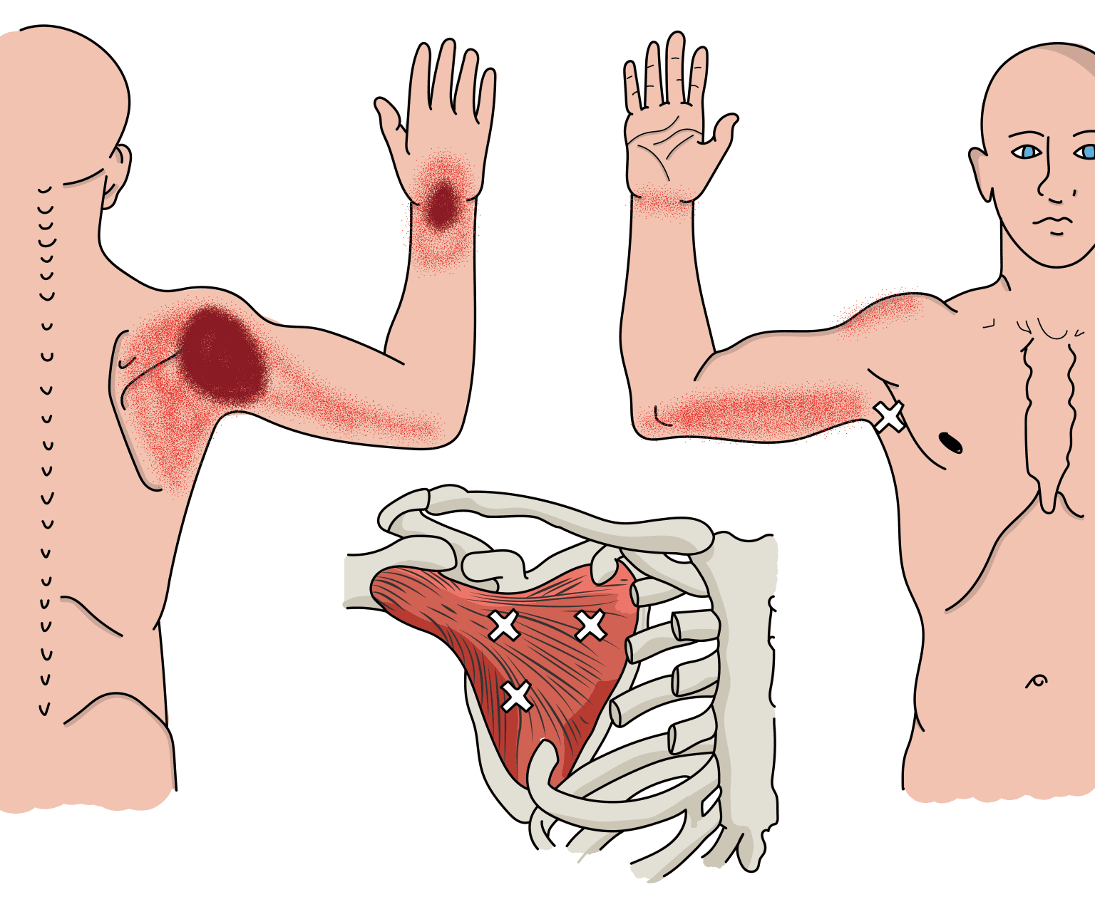 Ontdek Hoe Jouw Spieren Werken! | Fysiotherapie4all