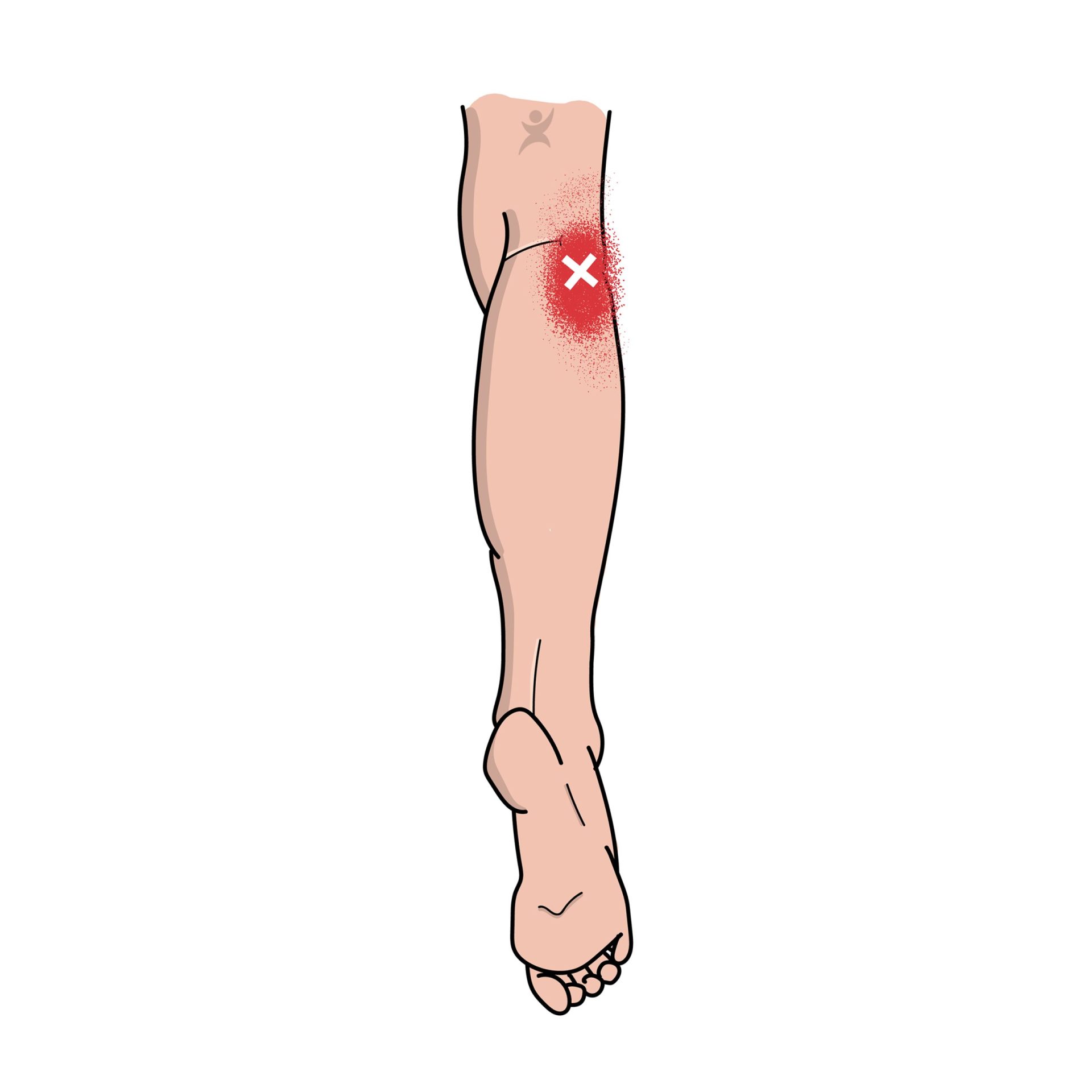 De Oplossing Voor Pijn Buitenkant Knie!