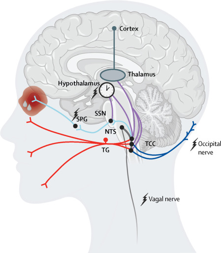 Ontdek Hoe Neurale Clusters En Neuroplasticiteit
